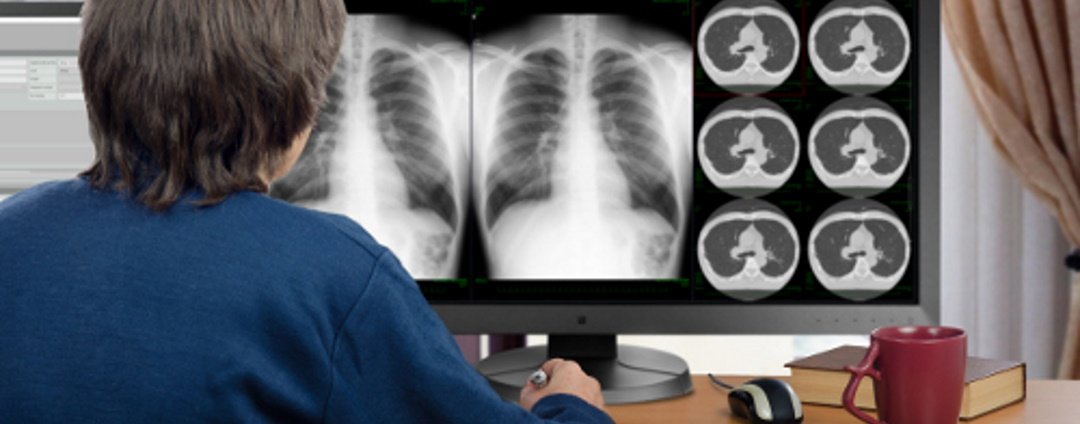 How Zscaler Improves Remote Radiology | Blog
